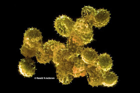 Microscope World Blog: Hibiscus Pollen under the Microscope