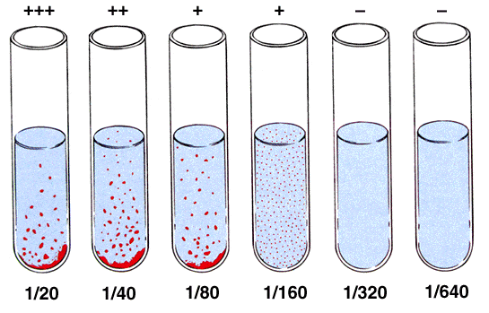 WIDAL REACTION (GRUBER WIDAL) - Microbiology Laboratory Turkey