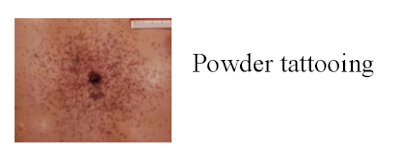 Brave New World - SFX unit: Contact or distant?