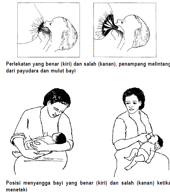 SEPUTAR IBU MENYUSUI: LANGKAH-LANGKAH MENYUSUI BAYI PALING BAIK dan BENAR