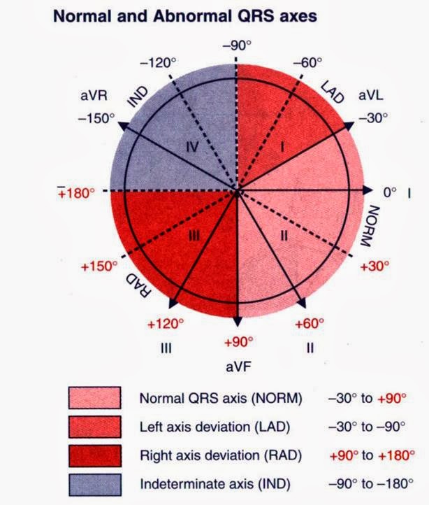 dokter-medis: Menentukan Sumbu Jantung Secara Cepat