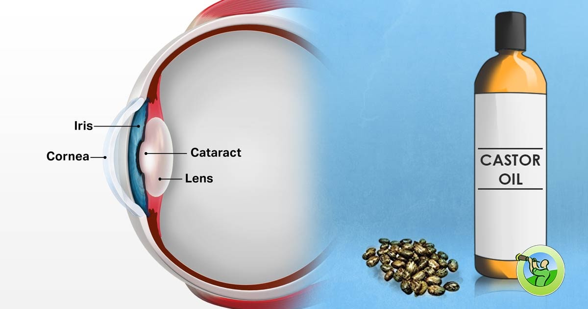 How To Use Castor Oil To Remove Cataracts And Improve Vision