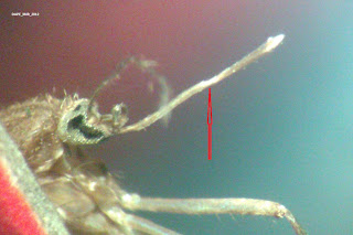 MEDICAL ENTOMOLOGY: Identification of Culex sp. (Adult)