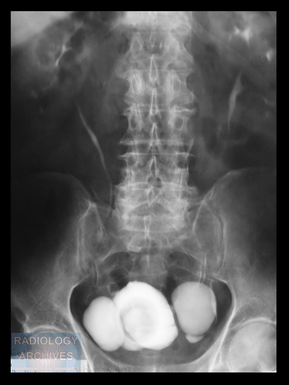 Radiology Archives: Ιανουαρίου 2013