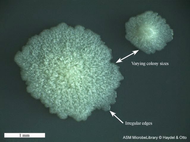 Phage therapy subjects from Sellano town : Morphology of Mature ...