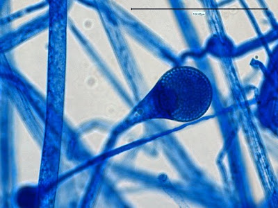 Fun With Microbiology (What's Buggin' You?): Absidia corymbifera ...
