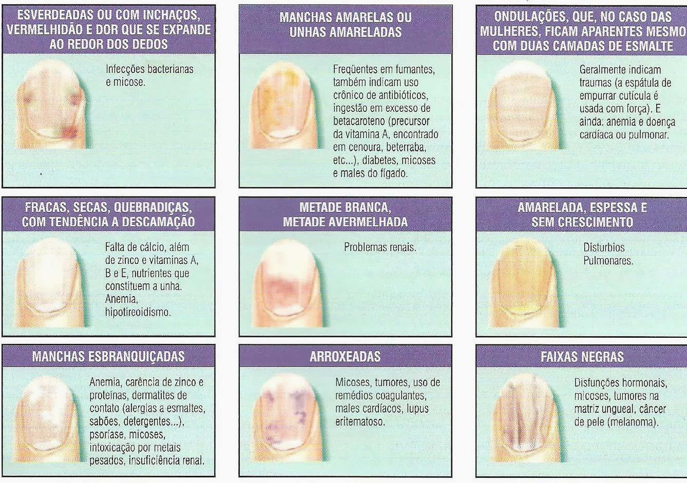 Nem te contei...: Unhas, Nutrição e Saúde - Têm Algo em Comum?