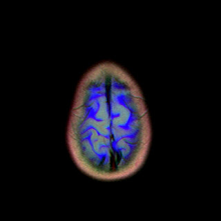 Nevit's blog: Color MRI of the Brain