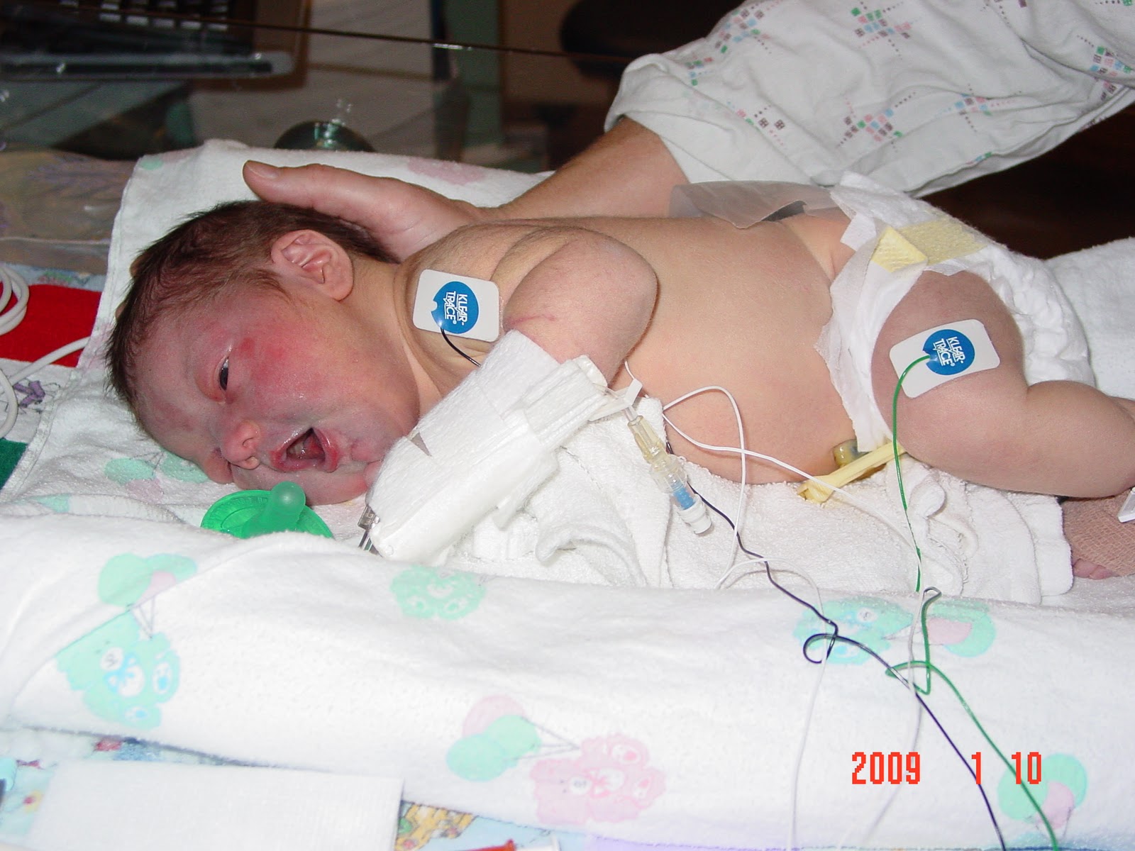 Simply Soares: Spina Bifida Awareness: Meet Madison!