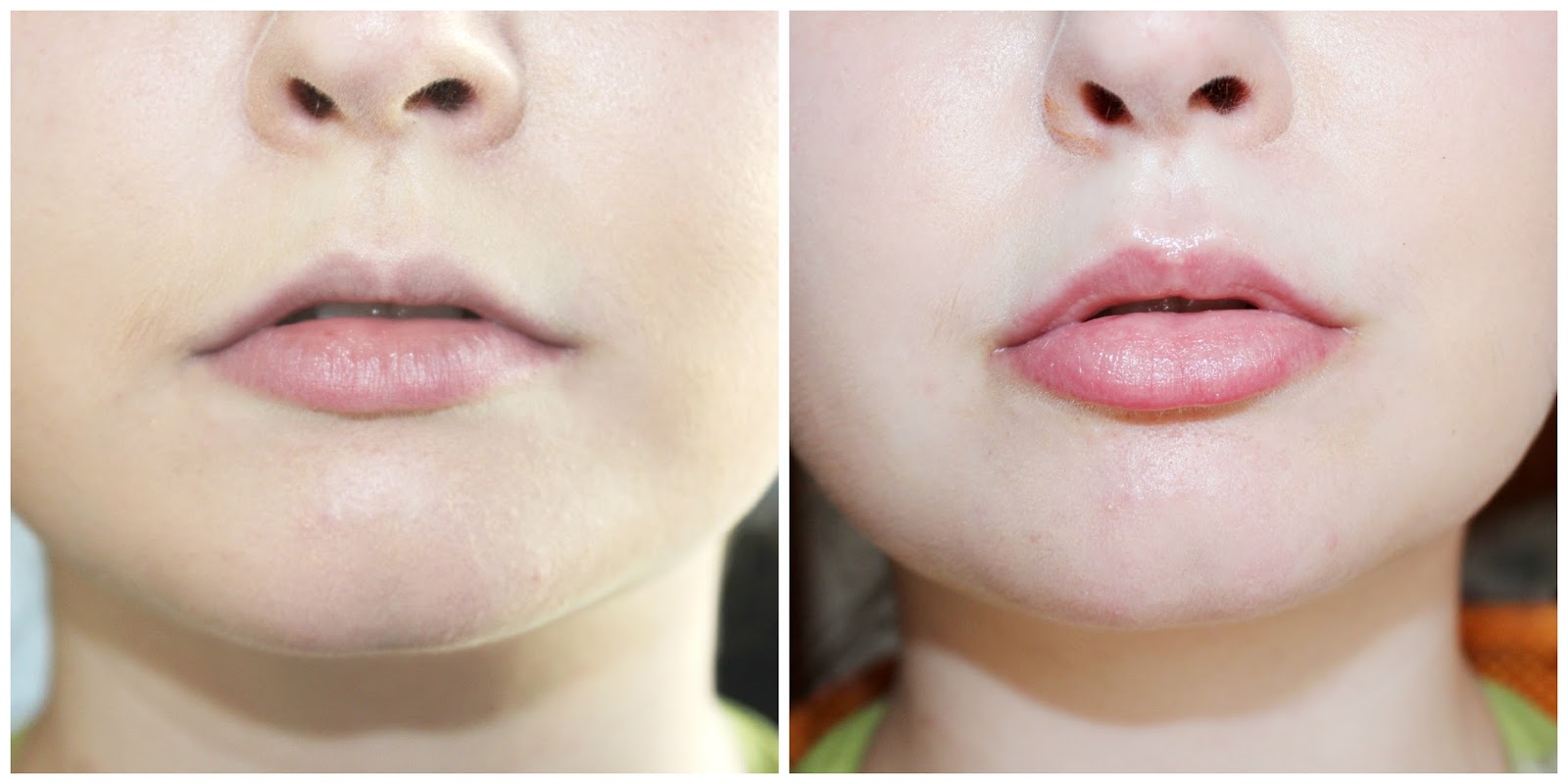 Aumenta tus labios sin cirugia | Señorita Bio