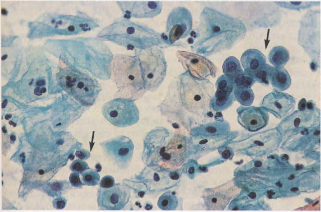 Histología Básica y Sistémica: Citología Cervical I