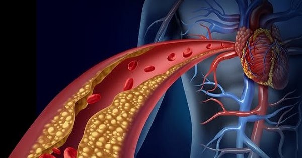9 Sinais Da Formação De Um Coágulo Sanguíneo - Saúde & Conhecimento