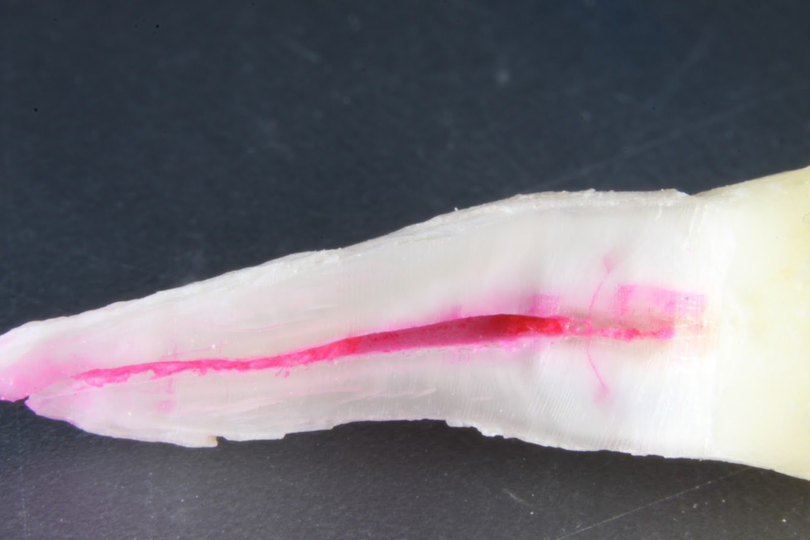 Zahnarzt Bochum Herne: Zahnarzt Herne: Wie entstehen eigentlich ...