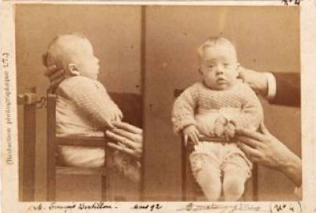 These 19th Century Mugshots of a 'Criminal' Toddler Are Adorable, But ...