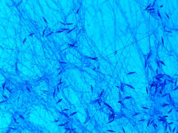 Fun With Microbiology (What's Buggin' You?): Microsporum canis