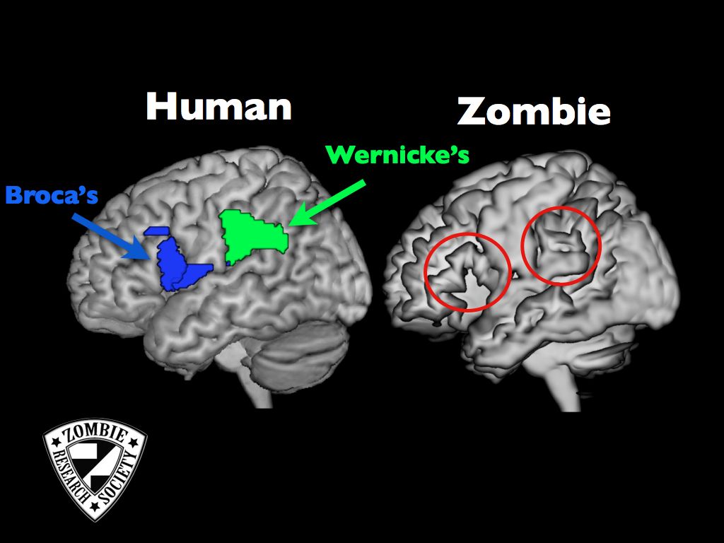 The Cognitive Axon: Zombie Brain: Language Deficits