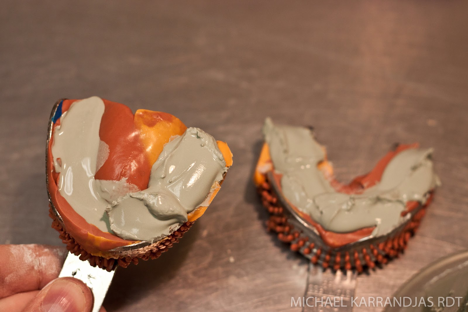 Dental Lab Model Pouring | Making Noise And Drinking Beer