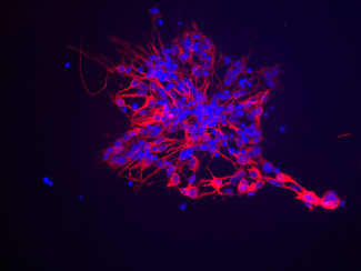 Neuromics: IF Staining of Human Primary Neurons