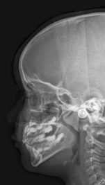 Estudo Radiográfico : ROTINA DE CAVUM