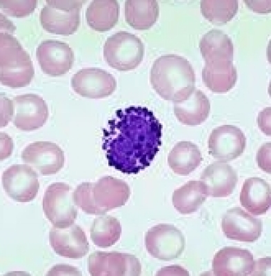 Hematología Fichas: Basófilo