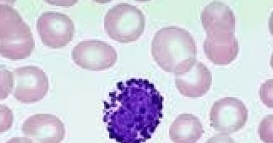 Fichero de Hematologia: Basófilo