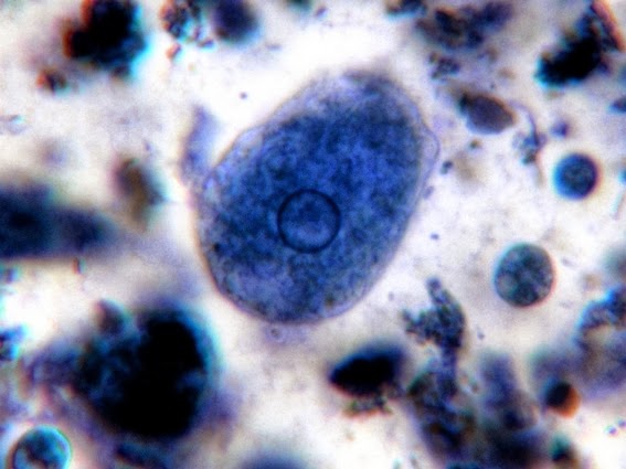 Fun With Microbiology (What's Buggin' You?): Entamoeba polecki