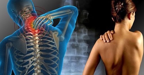 Qu’est-ce que la peste pulmonaire et quels sont ses symptômes