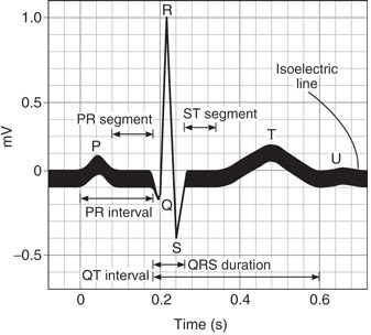 ECG waves, their meaning and normal duration. ~ Medicine Hack