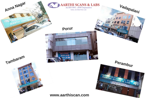 Aarthi Scans & Labs Chennai
