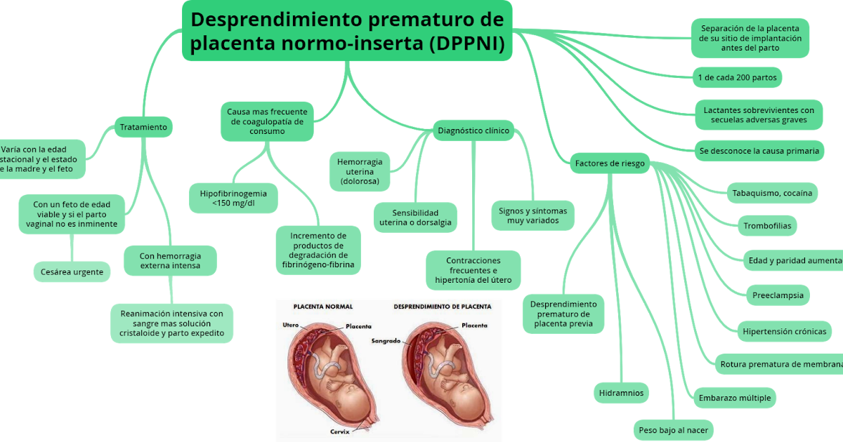 Desprendimiento prematuro de placenta normo-inserta. Les presento un ...