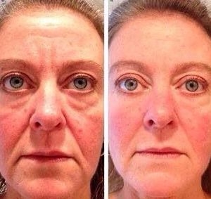 How To Look Younger With Facial Toning Regimens And Face Exercises