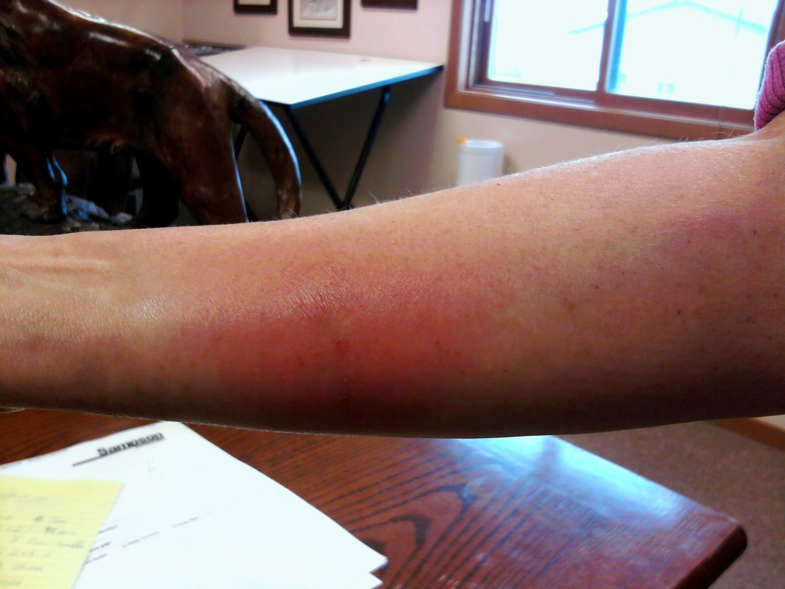 Pivotal or Trivial: Blood Suckers