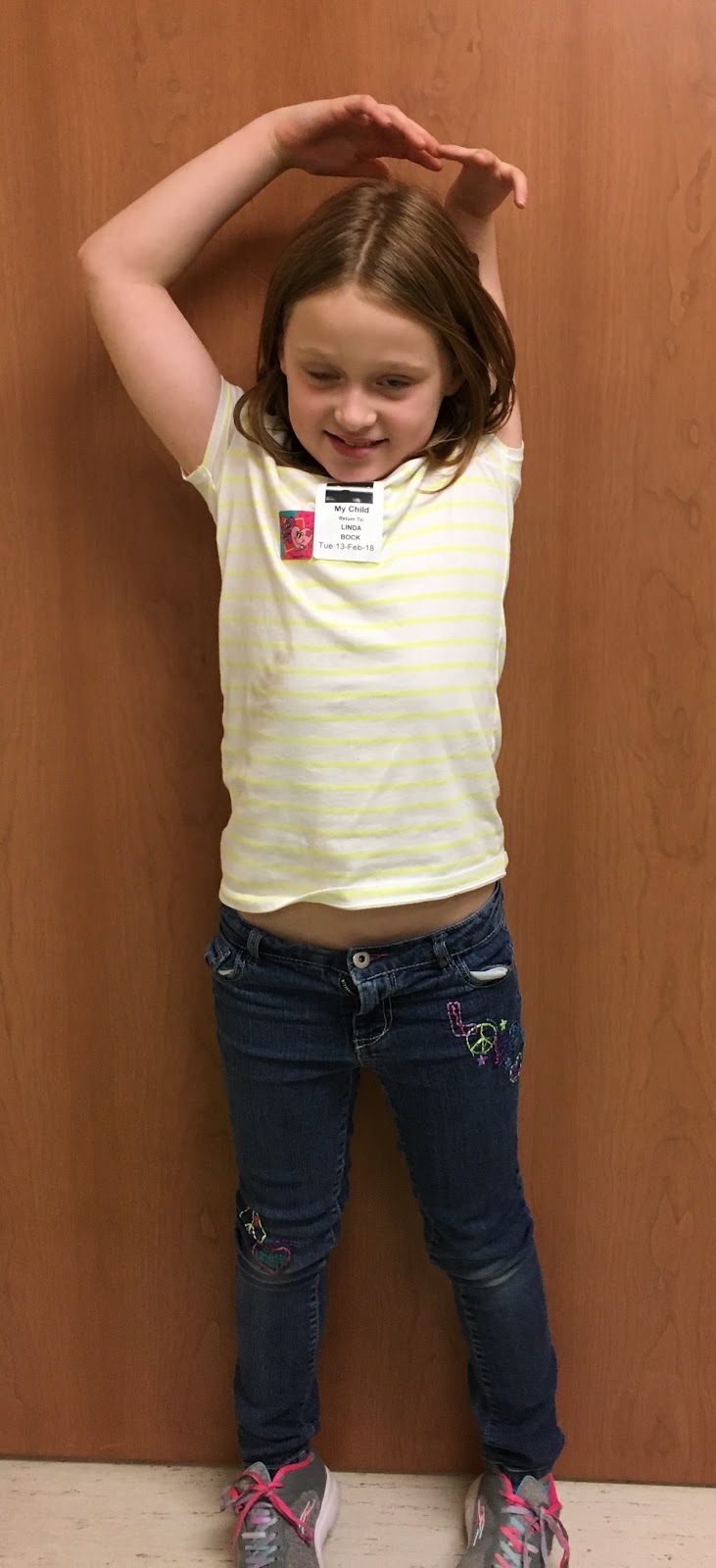 Ulnar Deficiency Follow Up | Congenital Hand and Arm Differences ...