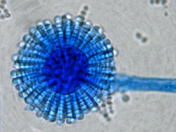 Fun With Microbiology (What's Buggin' You?): Syncephalastrum species