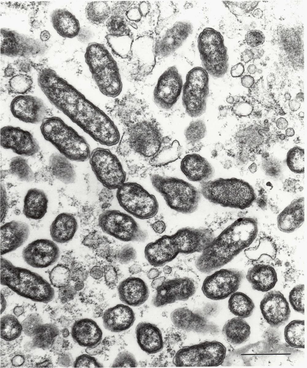 Microbiologia IFRJ - Campus Rio de Janeiro: TIFO