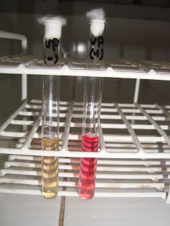 Medicolicious: Uji Biokimia Bakteri