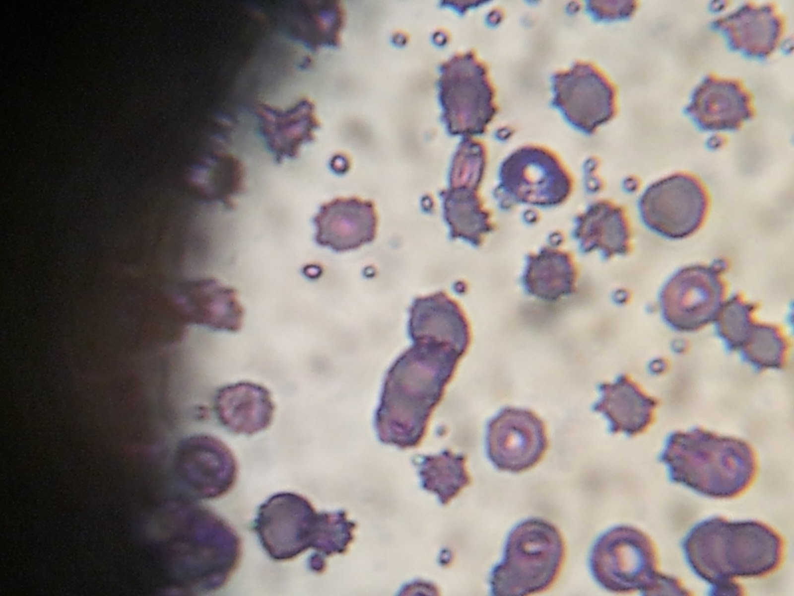 Tejidos animales y sangre. | Gori-Gori