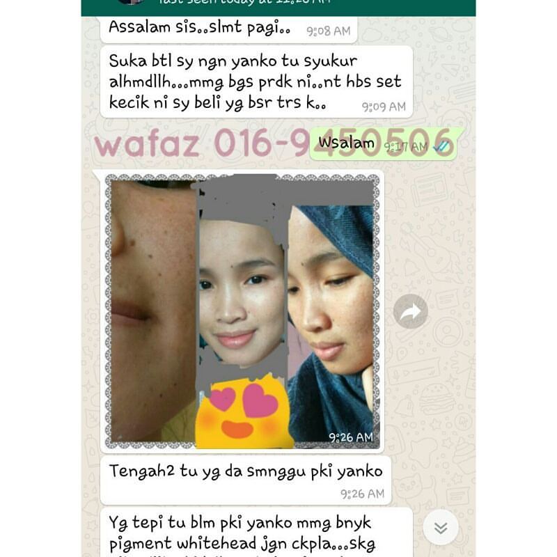 Natural Health Be Young: TESTIMONI YANKO SKINCARE