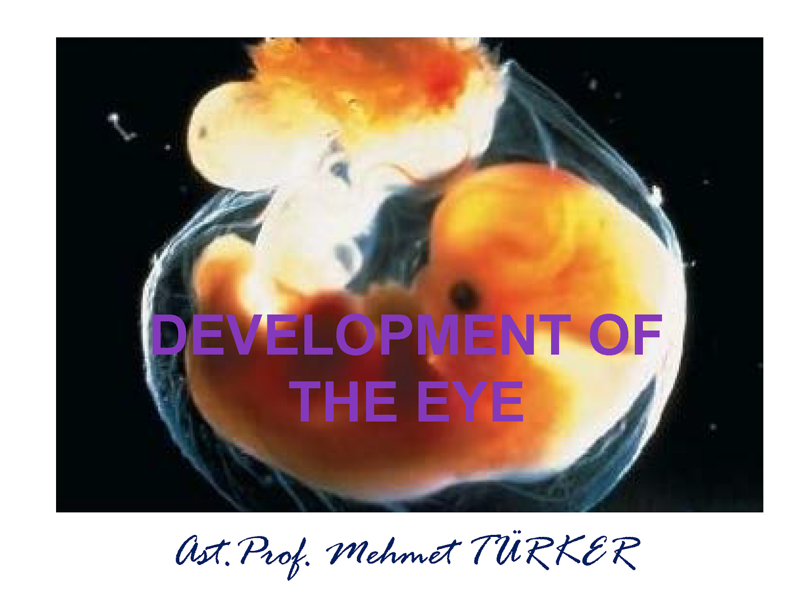 histoloji-embriyoloji notlarım: DEVELOPMENT OF THE EYE