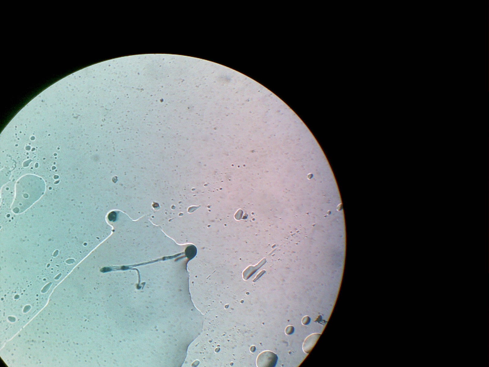 Ca - CaDo (Catatan Calon Dokter): Blok 9 : Praktikum Mikrobiologi ...
