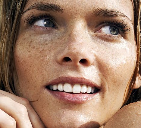 PREGUNTAS HABITUALES SOBRE LAS MANCHAS CUTÁNEAS Y EL MELASMA