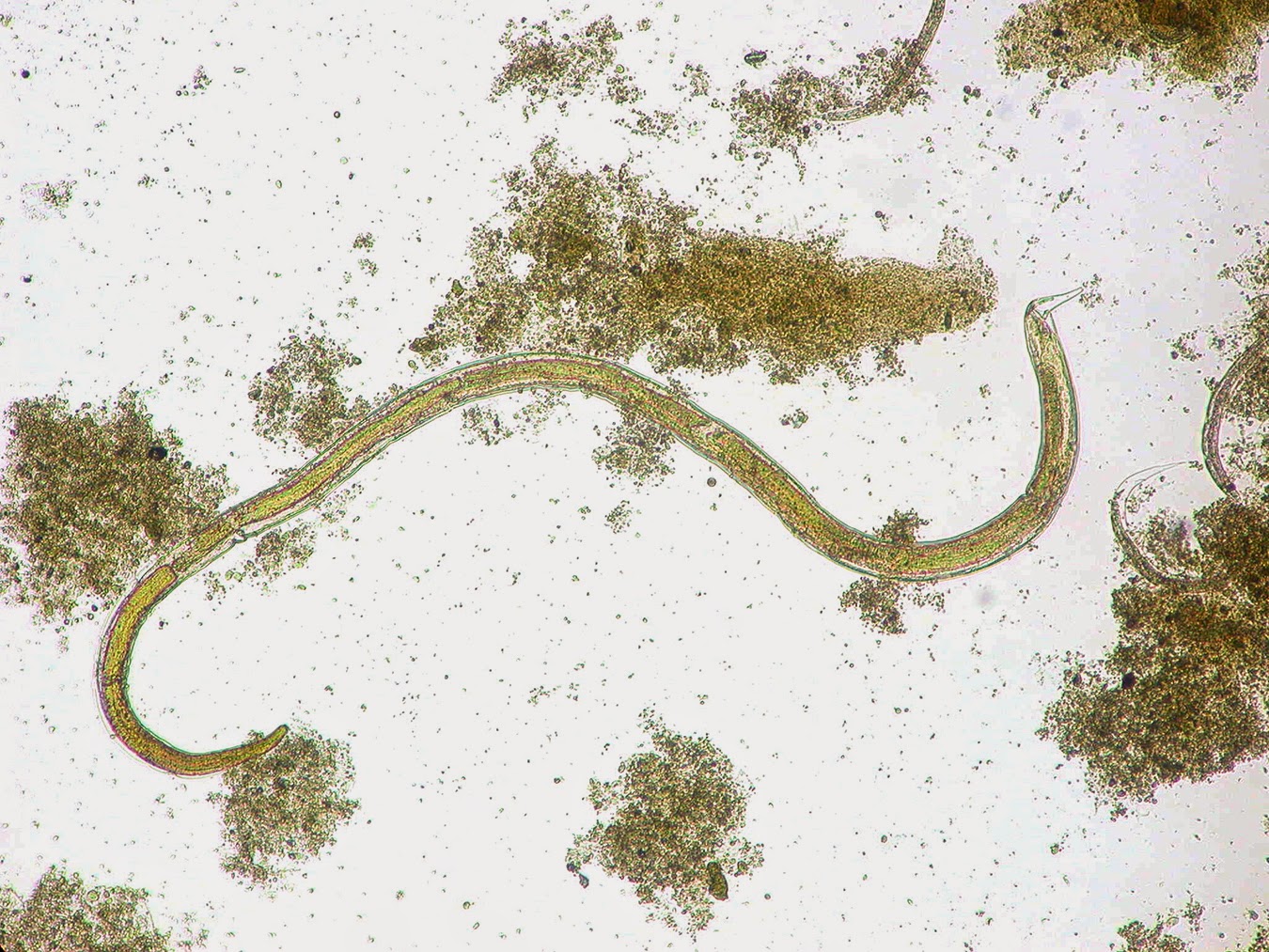 Creepy Dreadful Wonderful Parasites: Case of the Week 338