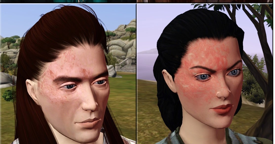 Загрузки для Sims Medieval : Burn scar by i-like-teh-sims - for TSM ...