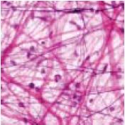 Struktur, Fungsi Dan Macam-Macam Jaringan Ikat Longgar, Padat, Dan ...