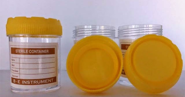 POT URINE STERILE 60 ML TUTUP KUNING | CONTAINER STERILE | PABRIK POT ...