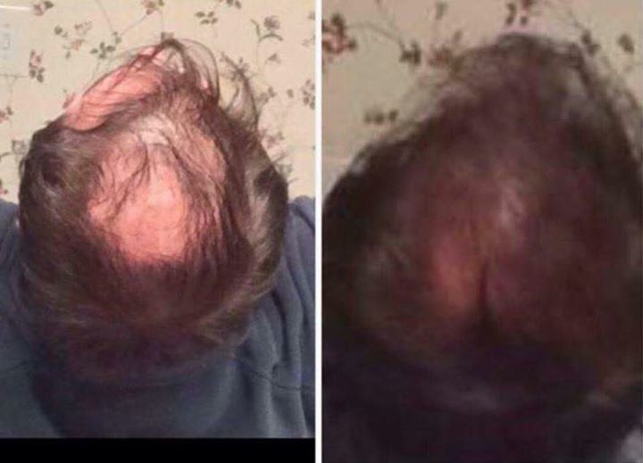 MONAT Global Revolutionary Hair Care Products: Amazing MONAT Before and ...