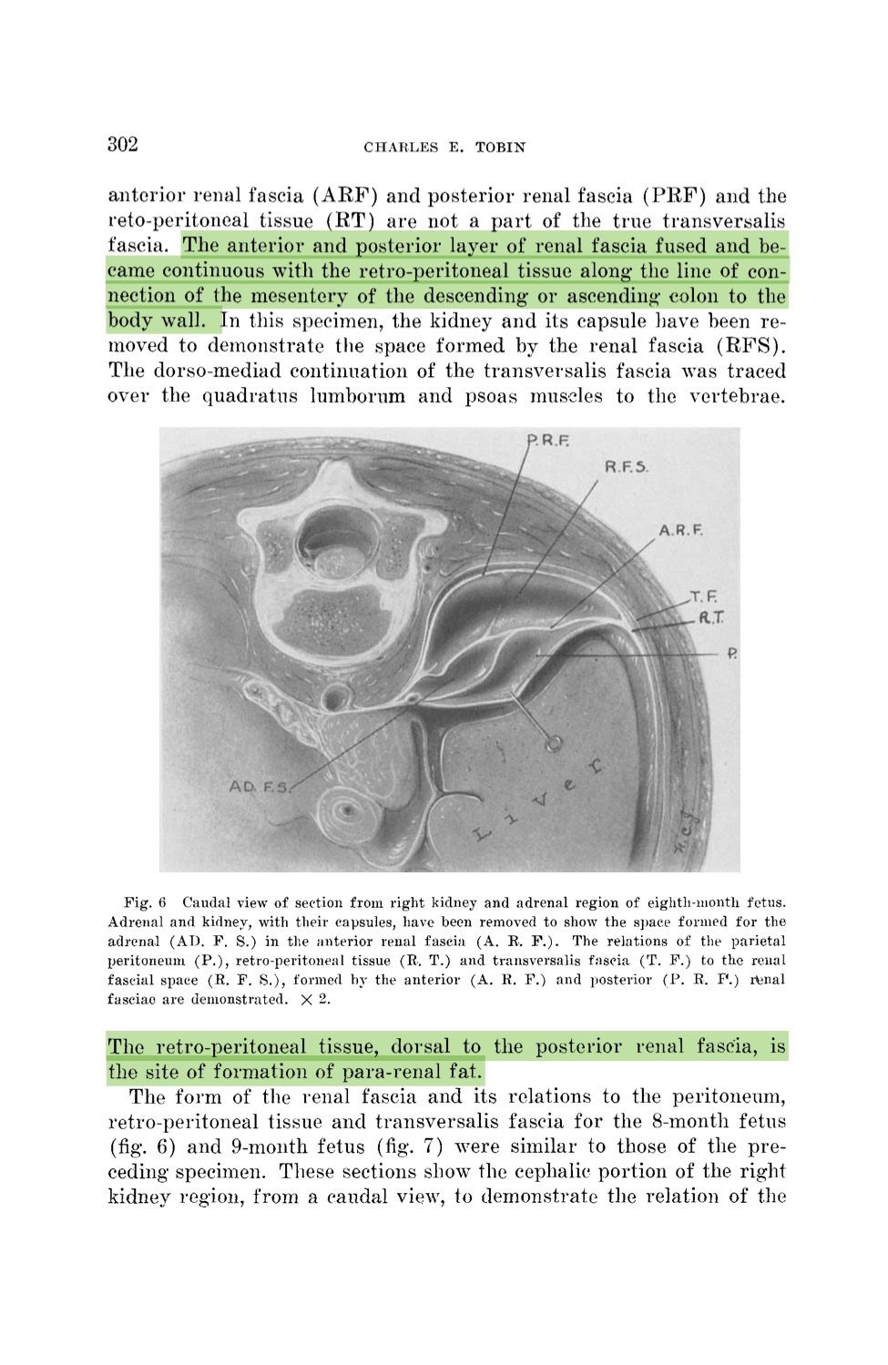 Transversalis Fascia Kidney Surgical Approaches For Open Renal