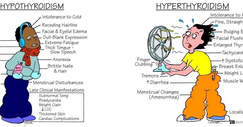 Hyperthyroidism vs. Hypothyroidism ~ The Issues of Hyperthyroidism