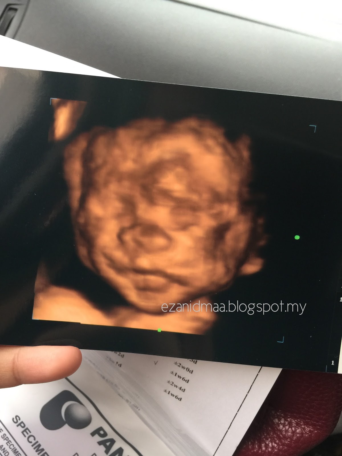 Ezan Idma: Review Scan 2d Detail + 3D4D di 3D 4D MALAYSIA di Hospital ...