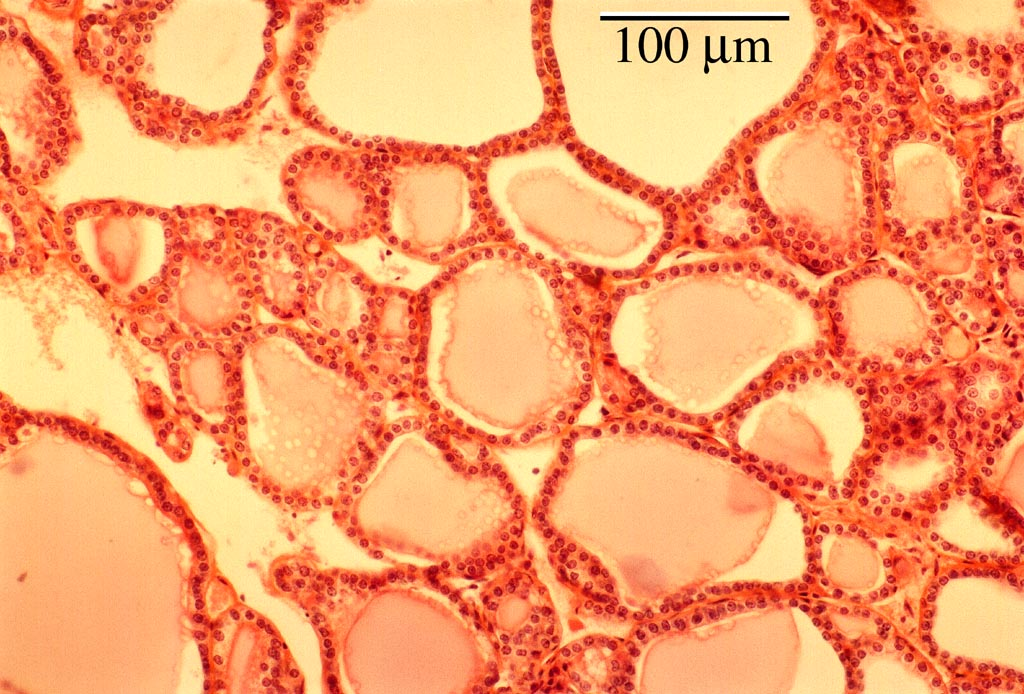 EPITHELIAL TISSUE Google Medicine EPITHELIAL TISSUE Google Medicine
